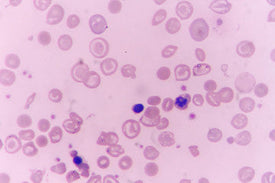 Nucleated Red Blood Cell Count: What Can This Mean? – welzo