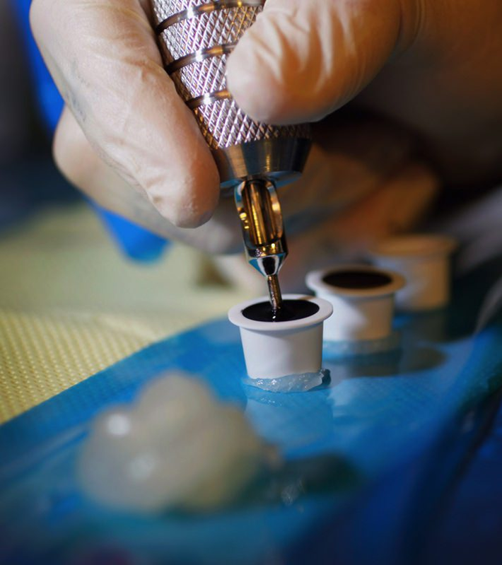 Ink Poisoning: Symptoms and Treatment - Welzo