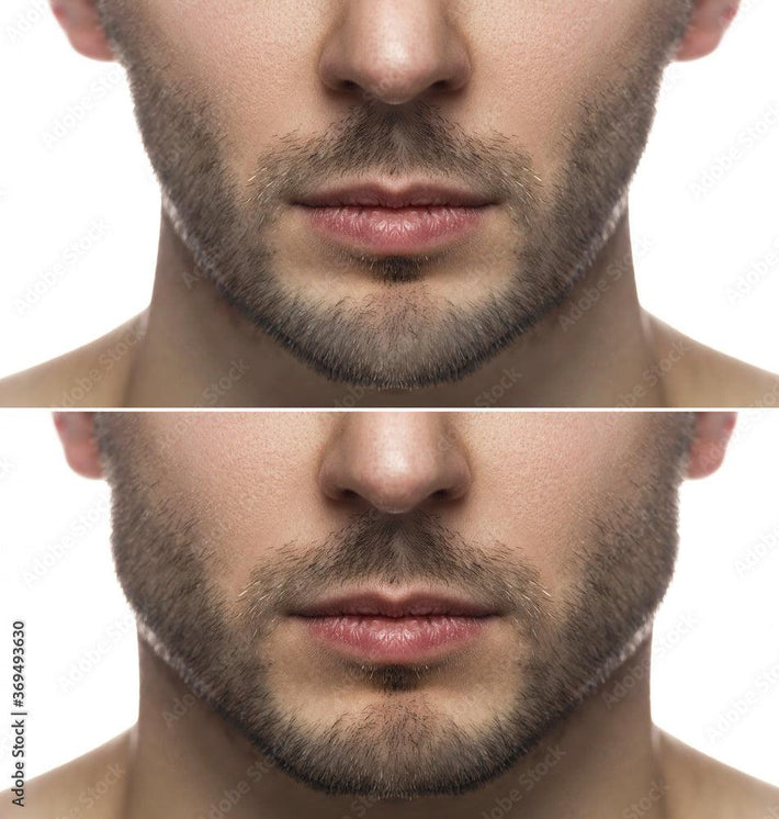 ¿Qué es Mewing? ¿Y funciona? – welzo