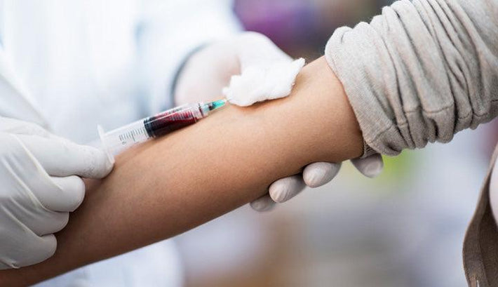 Why does my arm hurt after a blood test? | Welzo