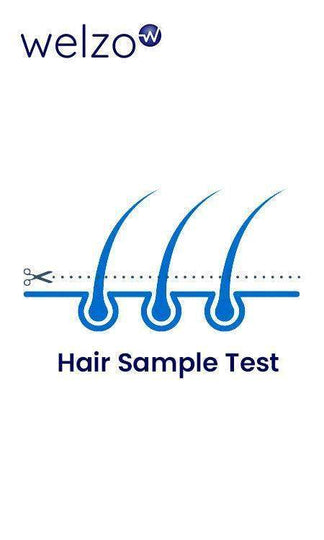 Premium Home Intolerance Test | Welzo